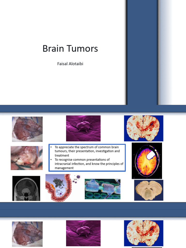 Brain Tumor and Infection. PNU | PDF | Brain Tumor | Glioma