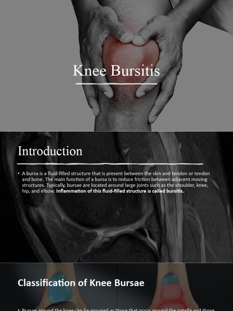 Knee Bursitis | PDF | Knee | Causes Of Death