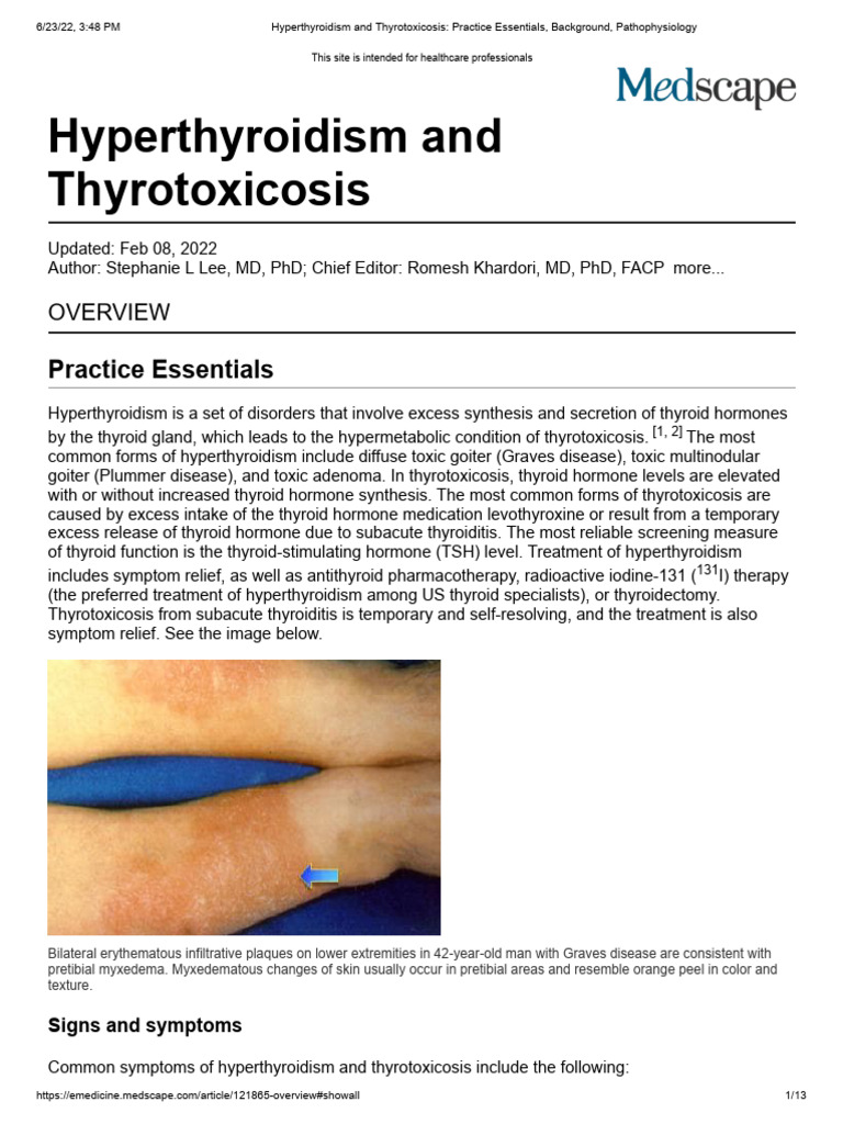 Hyperthyroidism and Thyrotoxicosis_ Practice Essentials, Background, Pathophysiology | PDF ...