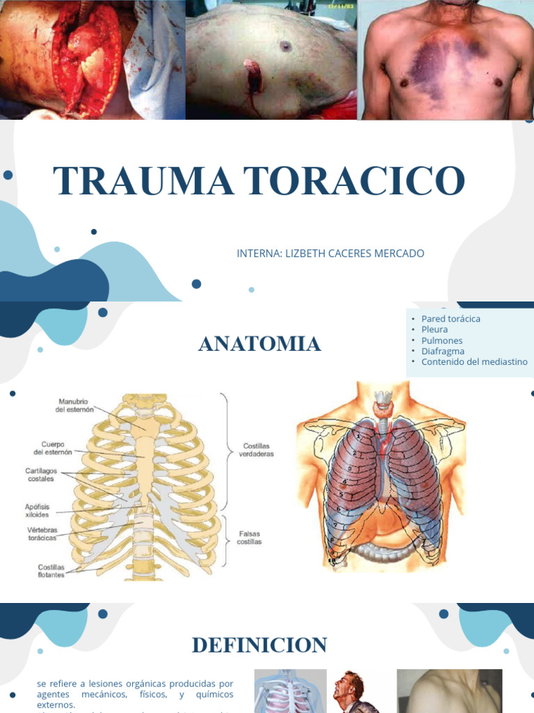 Trauma de Torax | PDF | Enfermedades y trastornos humanos | Enfermedades y trastornos