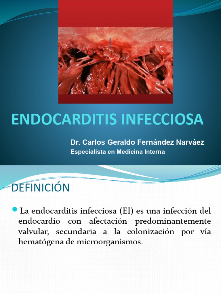 Endocarditis Infecciosa: Epidemiología y Tratamiento | PDF | Penicilina ...