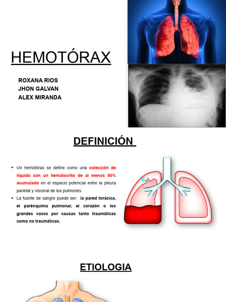 HEMOTORAX | PDF
