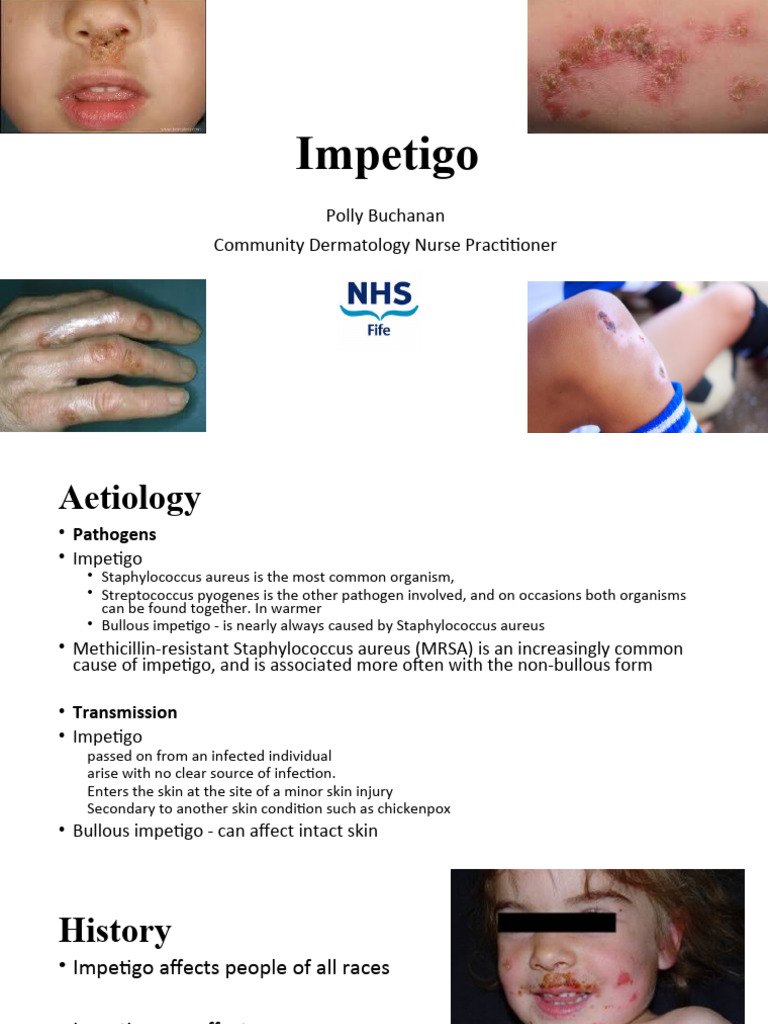 Impetigo PPT | PDF | Immunology | Health Sciences