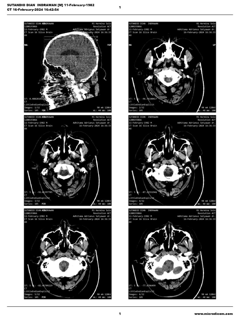 CTK Sutandio Dian Ax | PDF