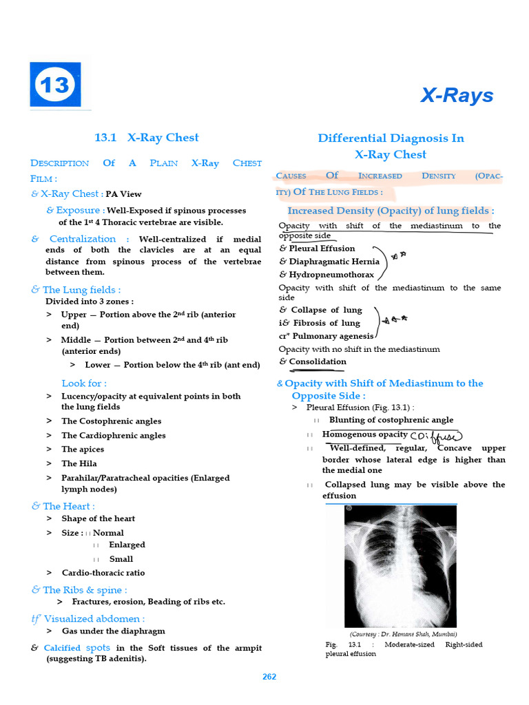 XRays | PDF