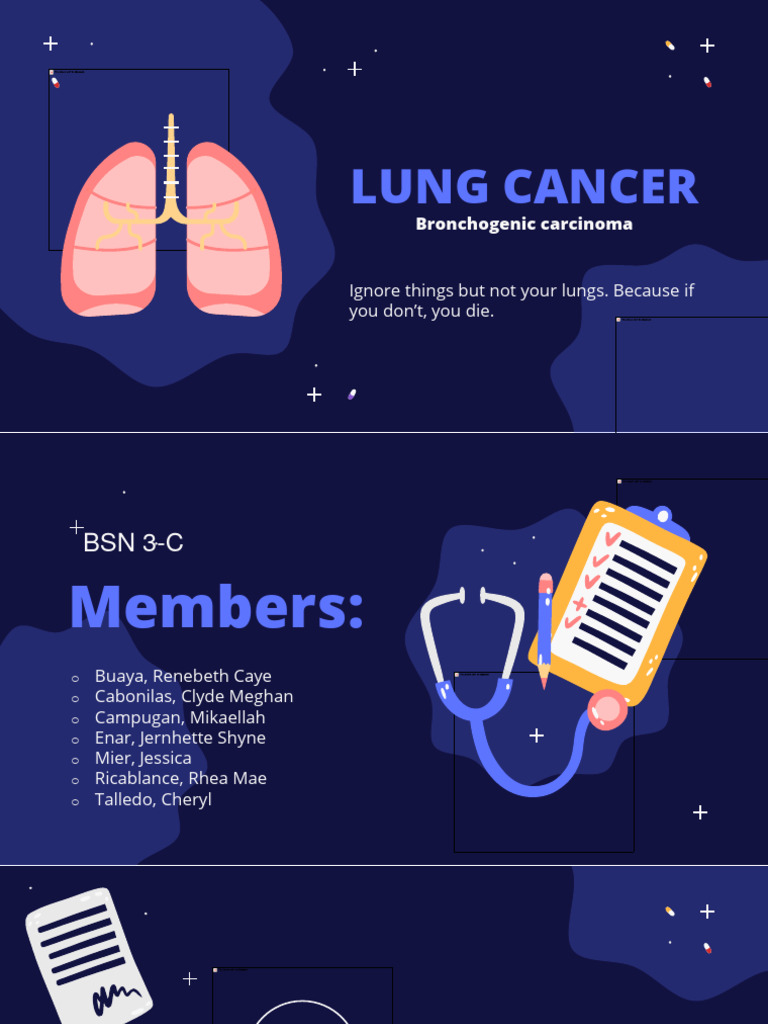 lung-cancer | PDF | Lung Cancer | Cancer