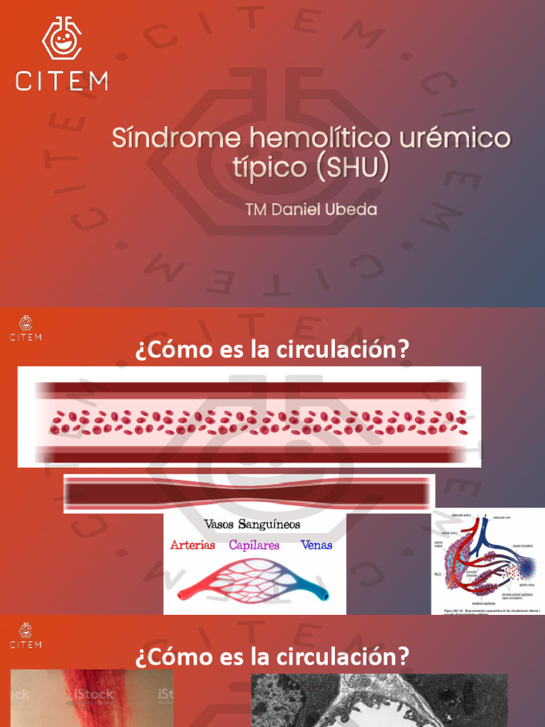02. [PPT] SHU | PDF | Escherichia coli | Anemia