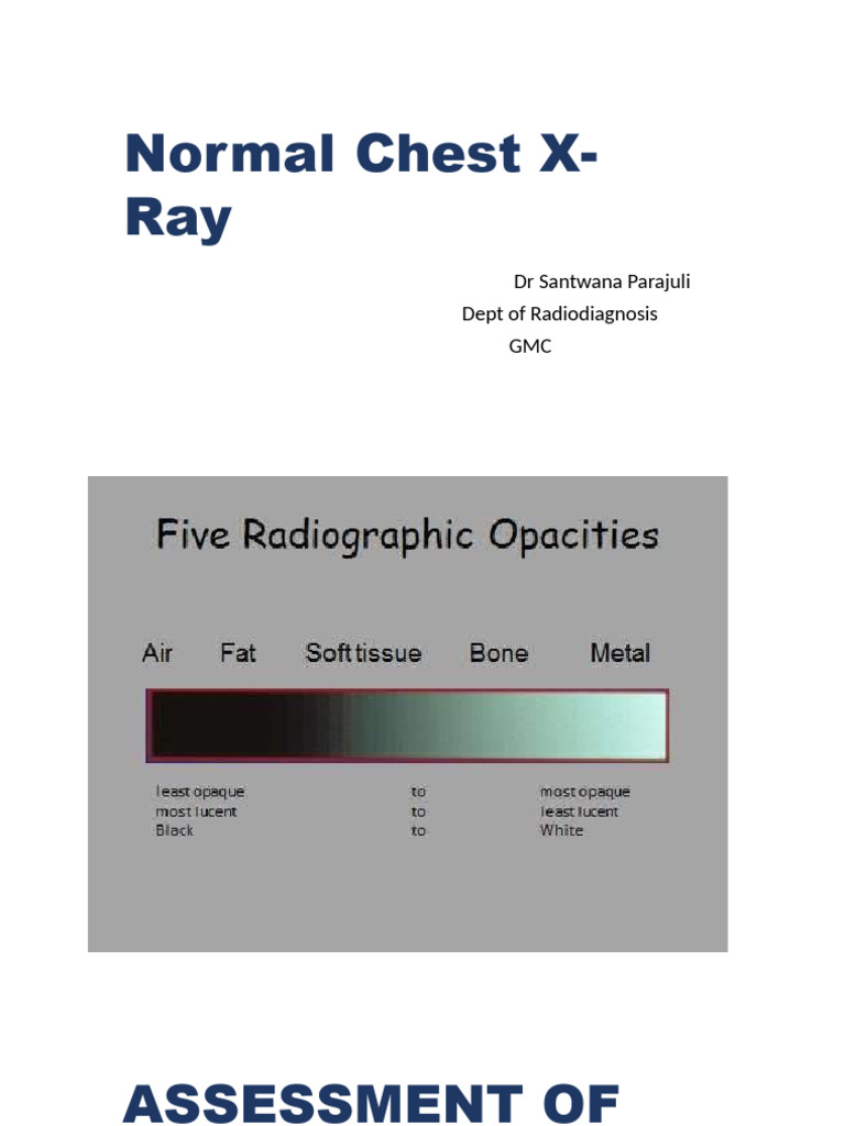 Class Chest Xray FINAL1 | PDF