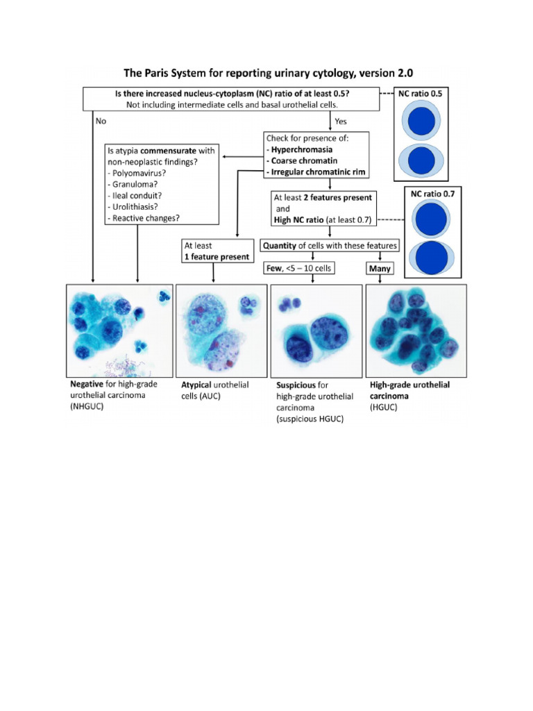 Paris System of Urinary Cytology | PDF