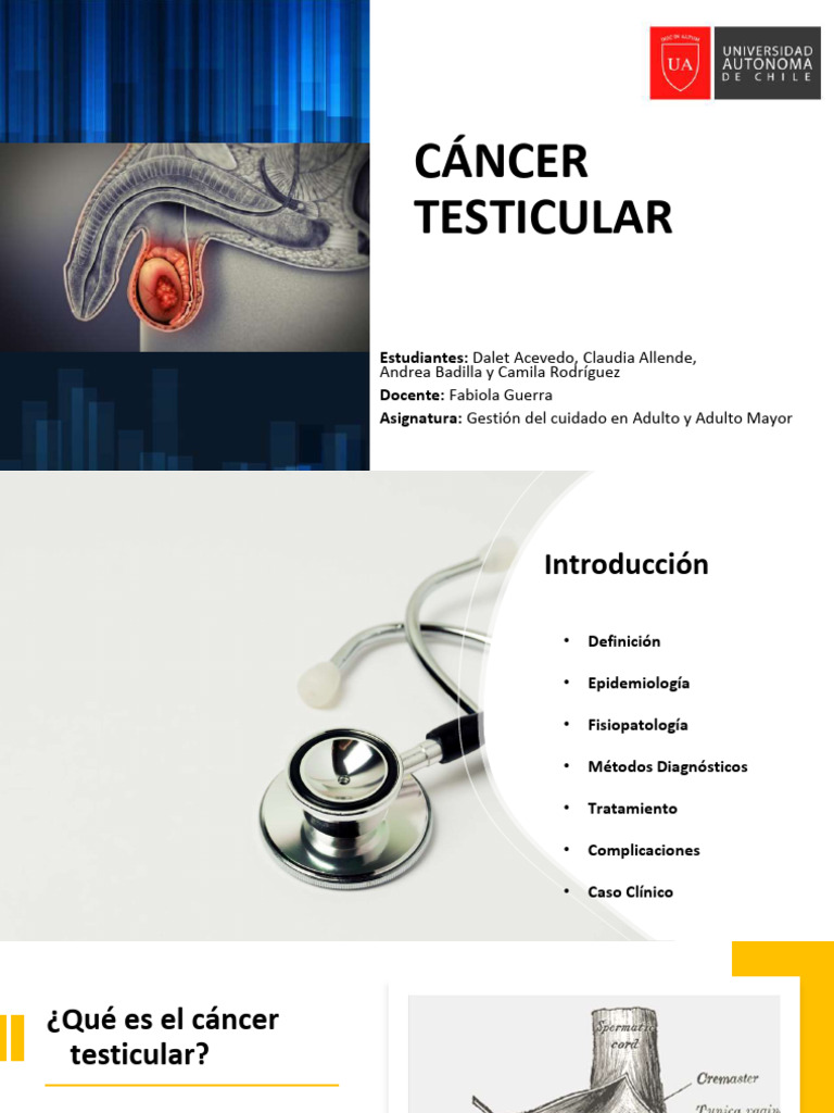 Presentación Cancer Testicular Pdf Cáncer Medicina Clinica