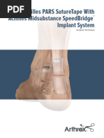 Brostrom Repair with InternalBrace Guide | PDF | Foot | Anatomical ...