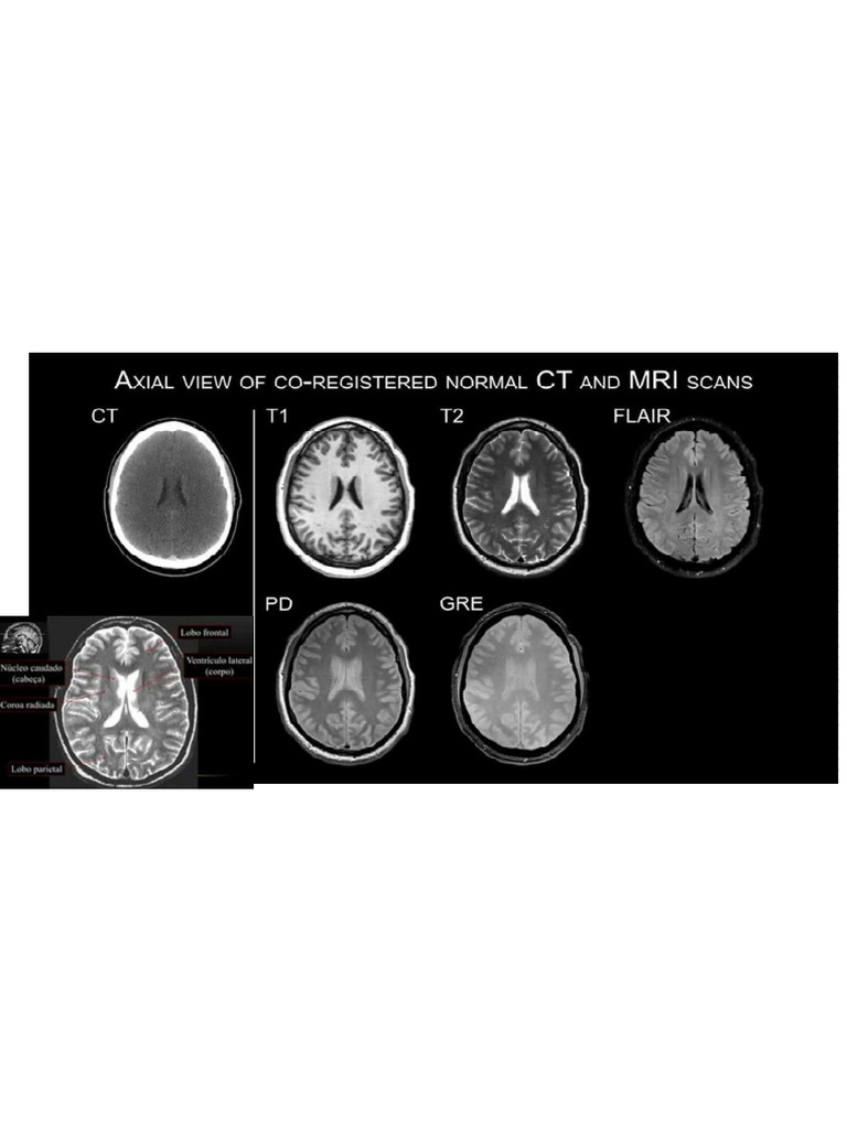 MRI | PDF