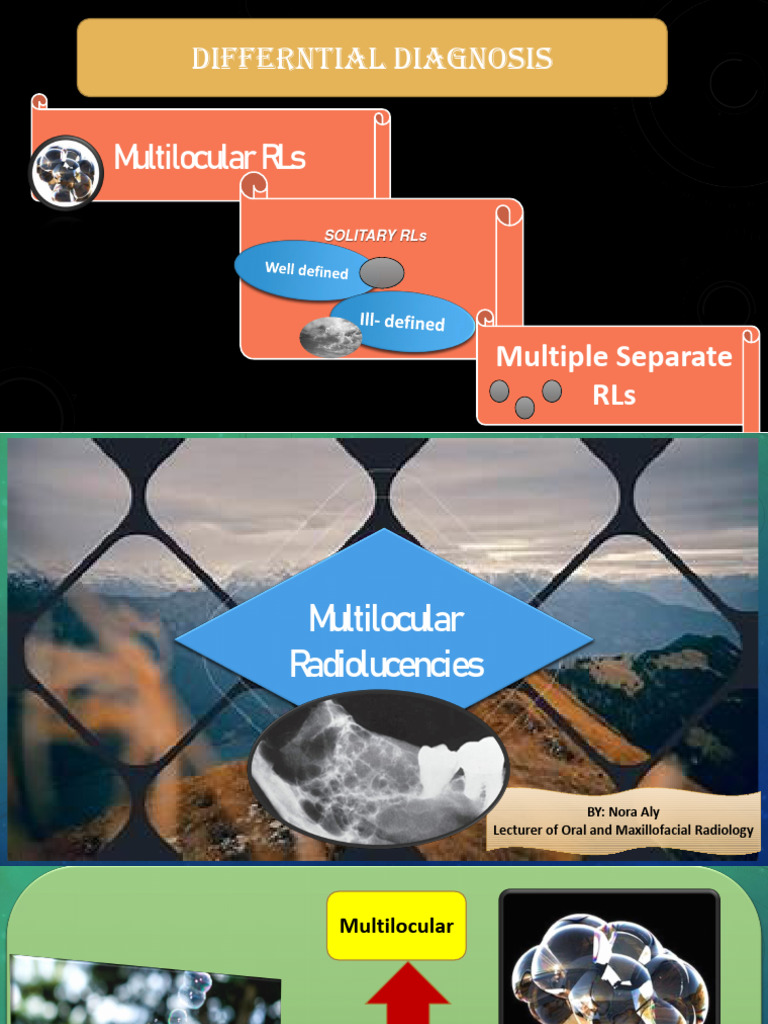 Multilocular Radiolucencies and Multiple Seperate PDF | PDF