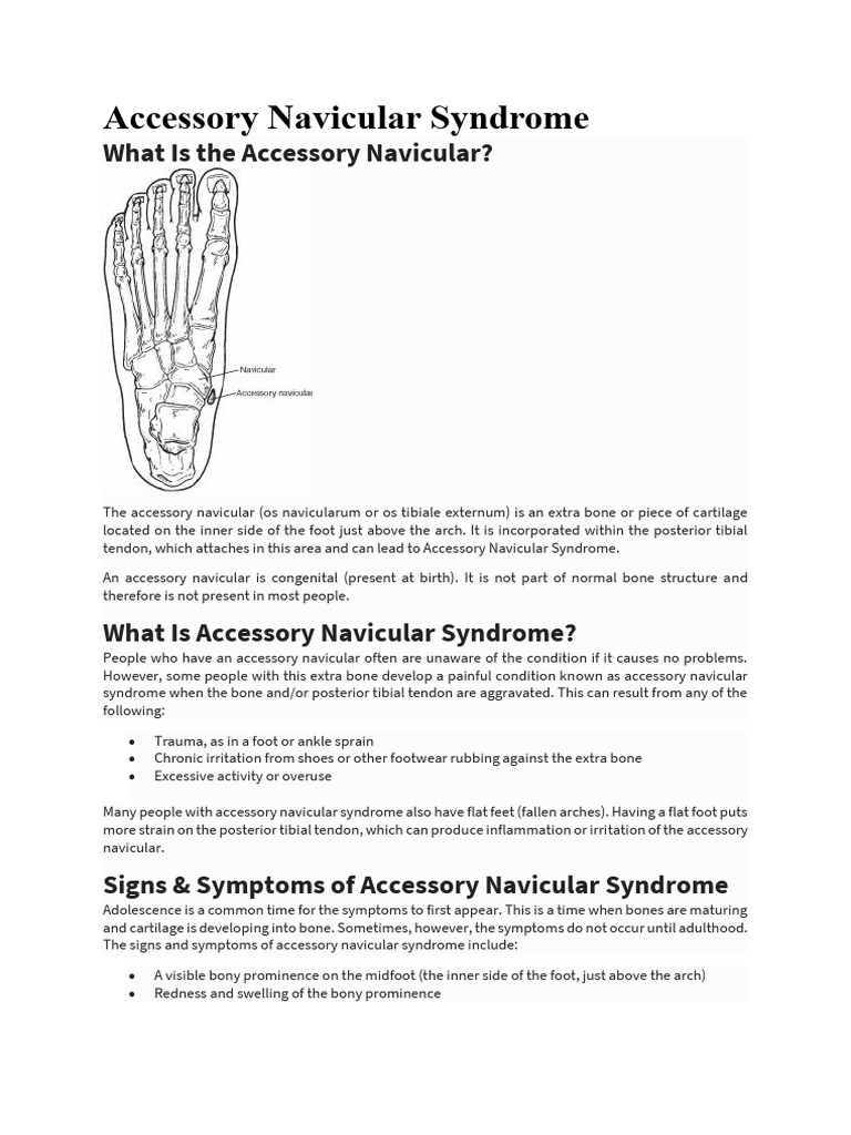 Accessory Navicular Syndrome Overview | PDF | Clinical Medicine ...