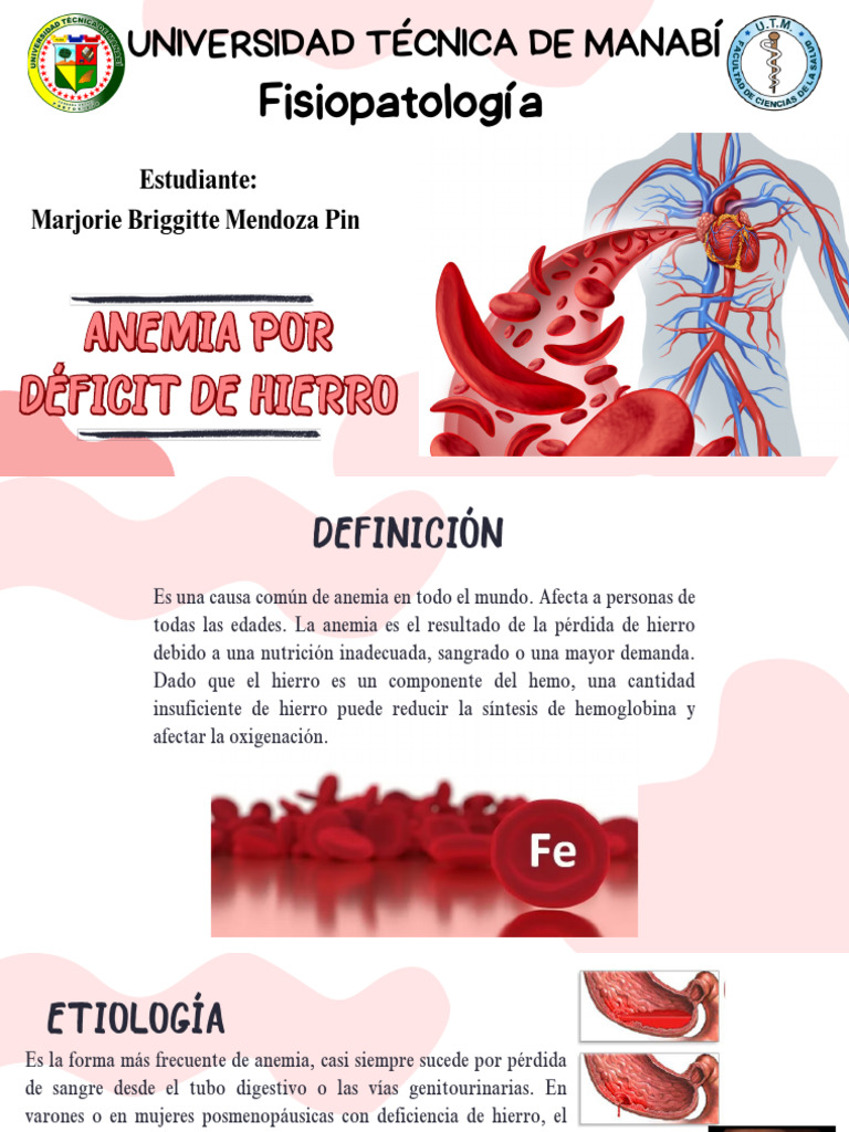 Presentación Anemia Por Deficit de Hierro | Descargar gratis PDF ...