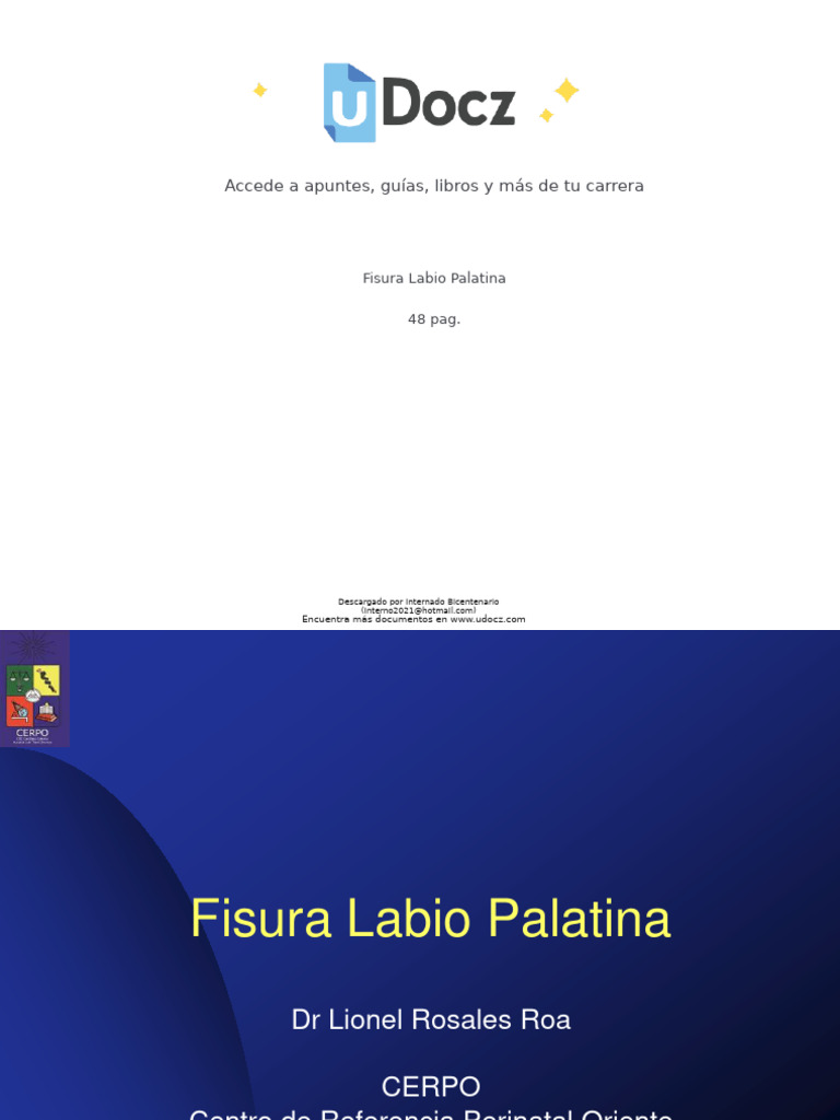 DIAPOSITIVA LABIO PALATINO Y FISURA LABIAL | PDF | Boca | Anatomía humana