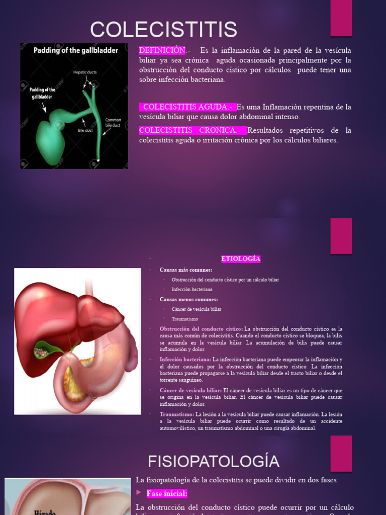Colecistitis Definicion, Etiologia y Fisiopatología | PDF | Vesícula ...