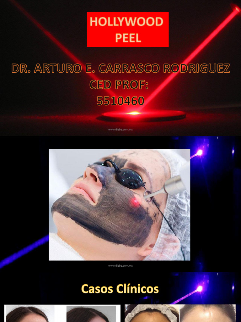 Presentación Hollywood Peel PDF (1) | PDF