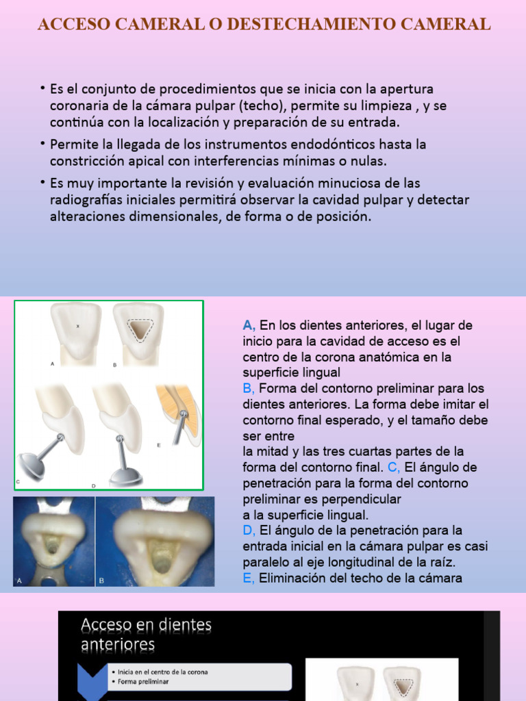 Acceso Cameral en Endodoncia | PDF | Odontología | Ramas de Odontología