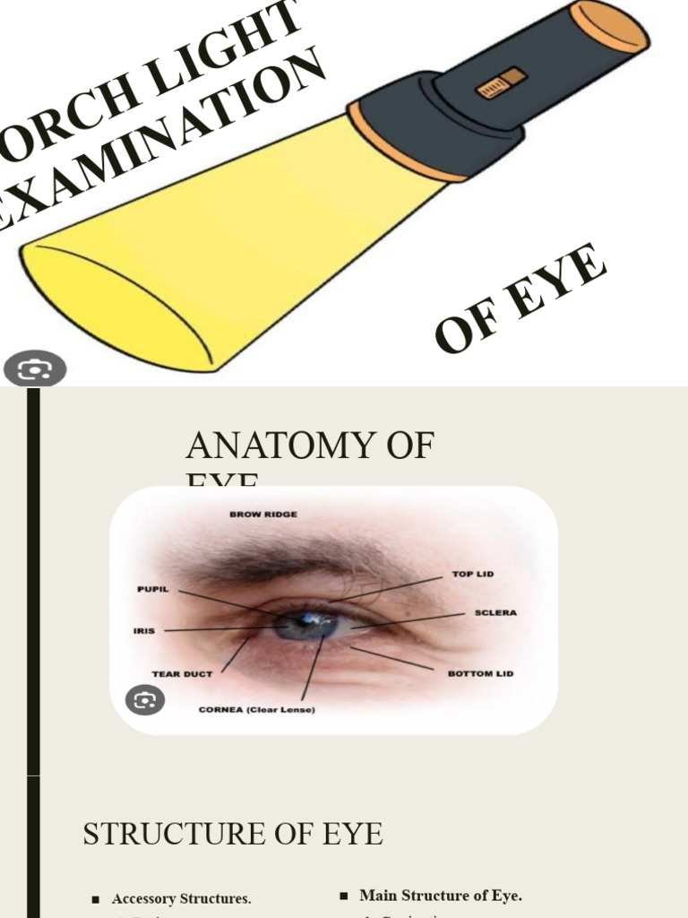 Torch Light Eye Examination Guide | PDF