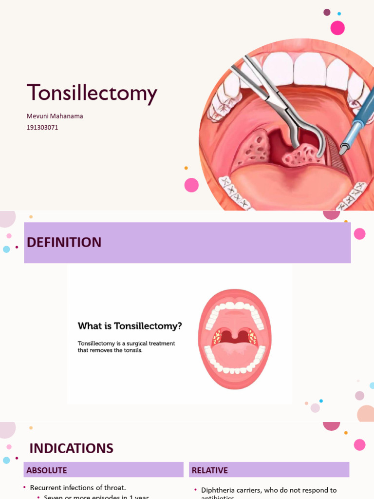 Tonsillectomy | PDF | Clinical Medicine | Causes Of Death