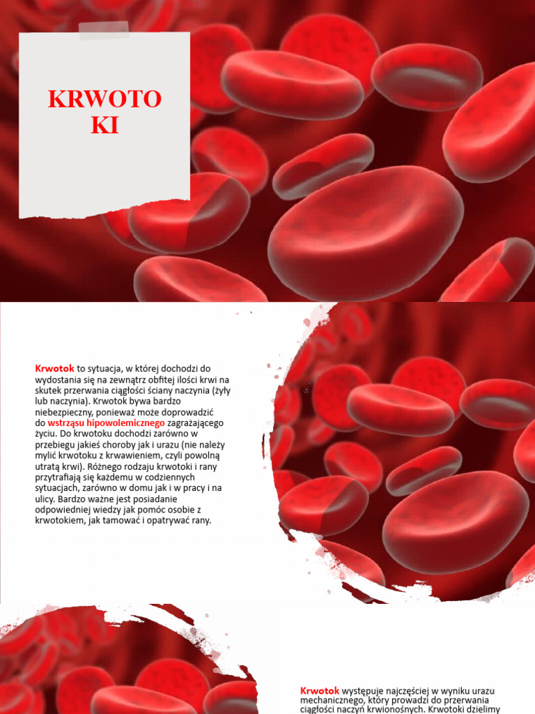 Krwotoki | PDF