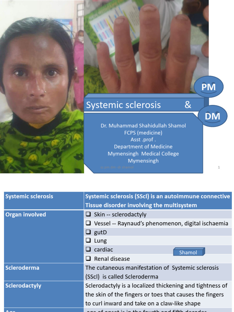 Systemic Sclerosis Shamol Tab Version | PDF | Epidemiology | Causes Of ...