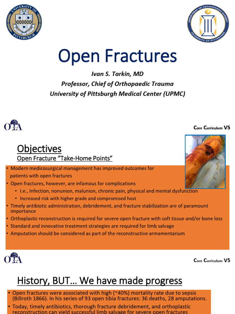 General B2 Open Fractures | PDF | Medical Specialties | Surgical ...