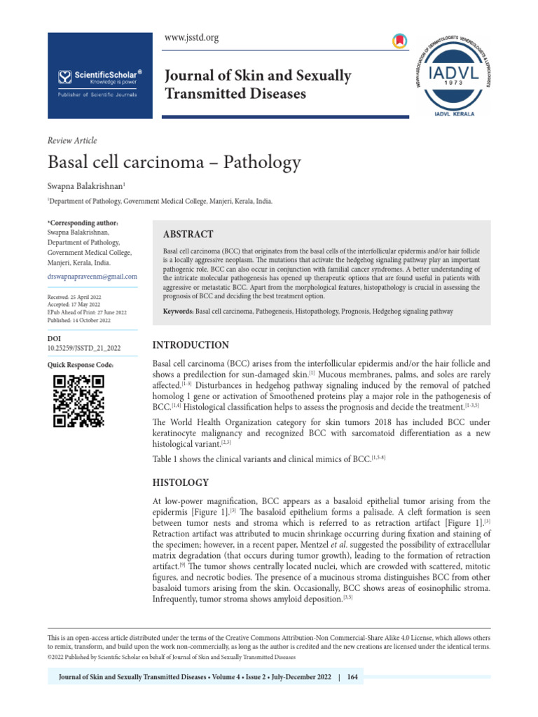 Basal Cell Carcinoma - Pathology | PDF | Medical Specialties | Clinical ...