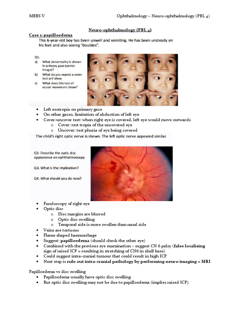 Ophthalmology - Neuro-Ophthalmology PBL Case 4 | PDF | Human Eye ...