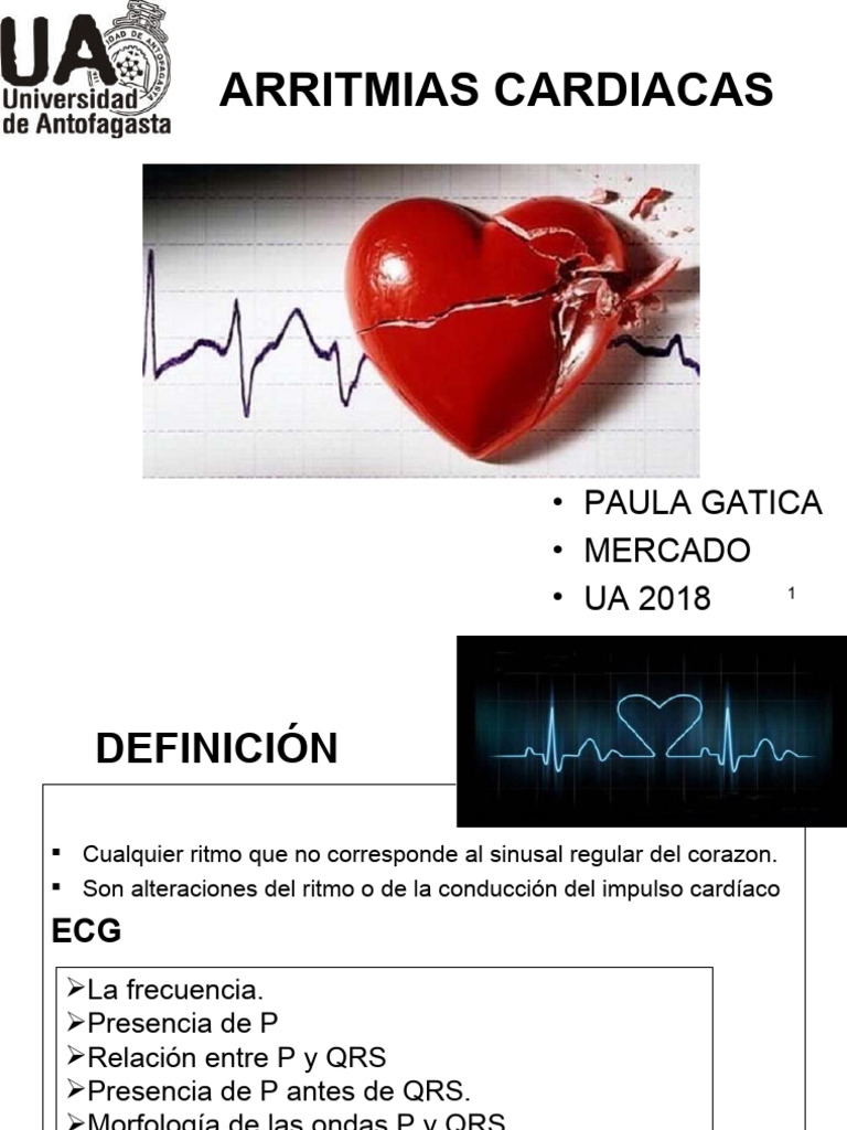 Arritmias y Cardioversion 2018 PDF | PDF | Electrocardiografia | Fisiología