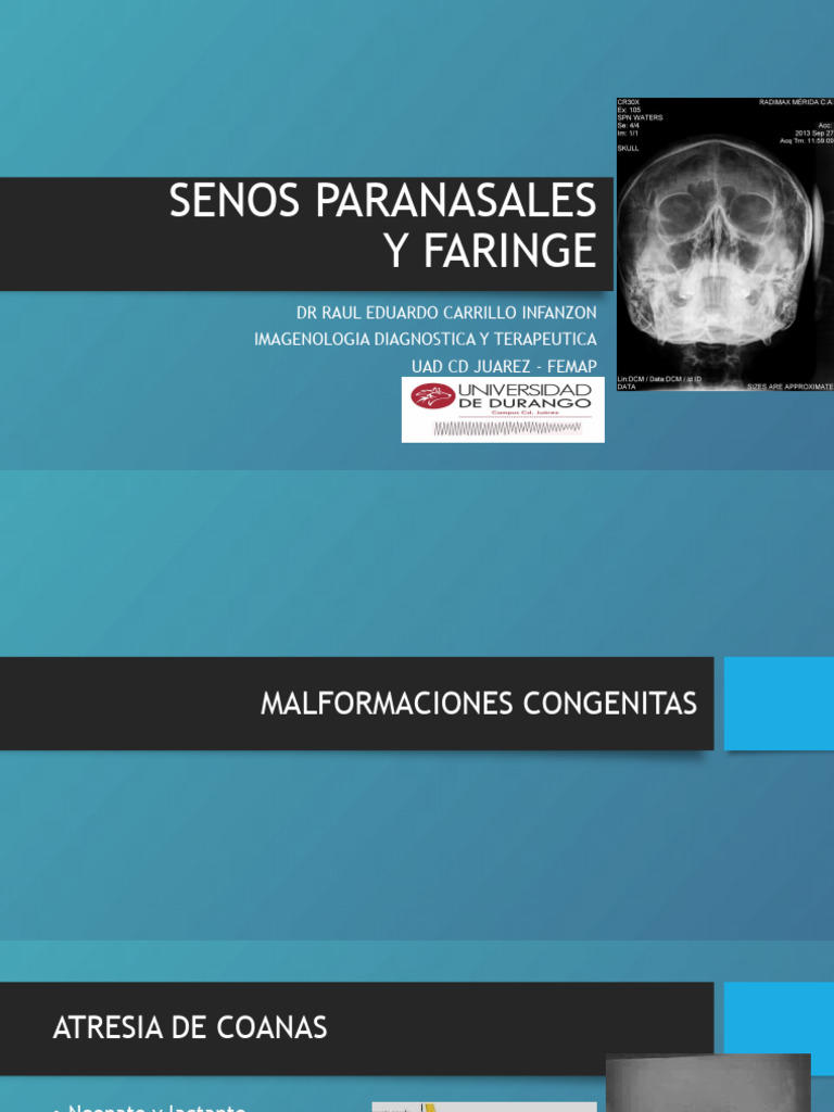 Malformaciones y Enfermedades de Senos Paranasales | PDF | Neoplasias ...