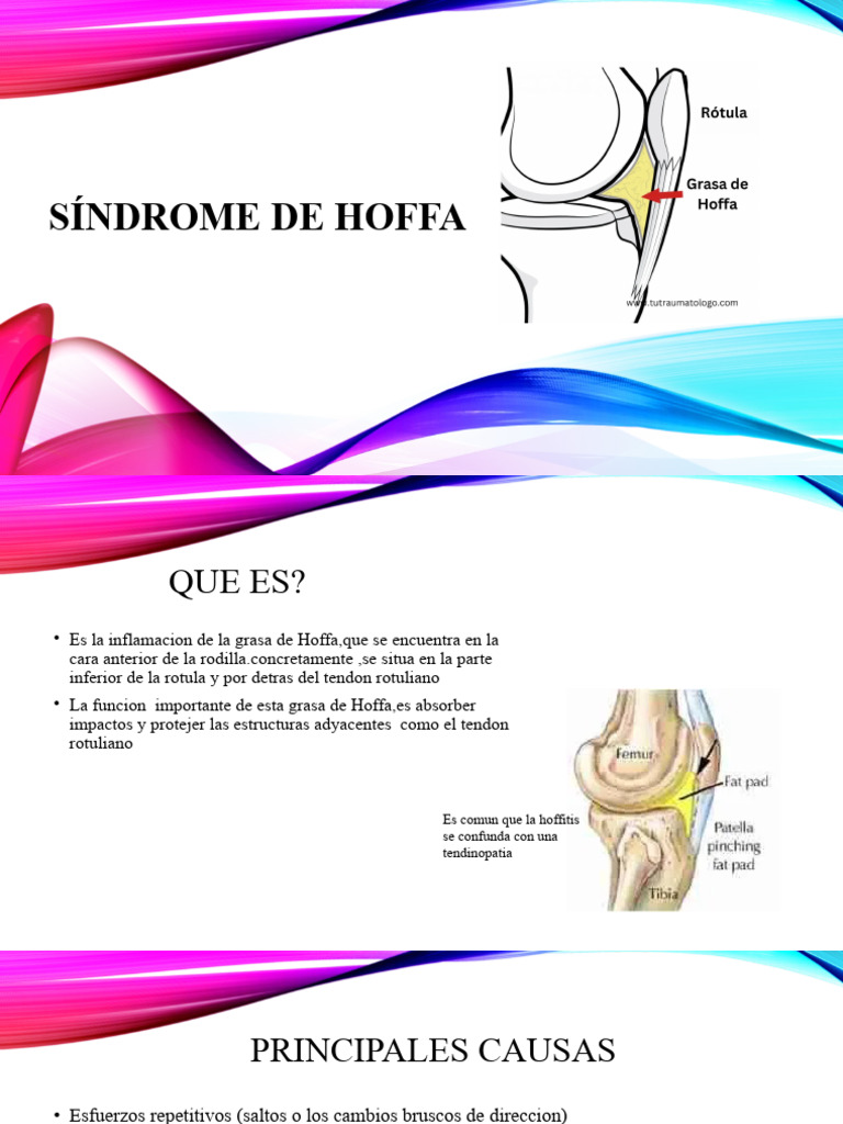 Hoffitis de Rodilla: Causas y Tratamiento | PDF