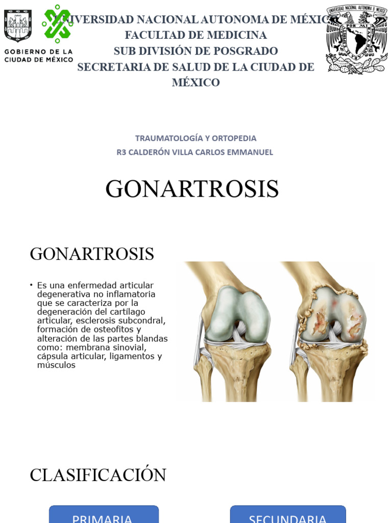 GONARTROSIS | PDF | Articulación | Cartílago