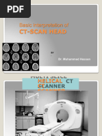 CT Brain Interpretation Guide | PDF | Stroke | Cerebrospinal Fluid
