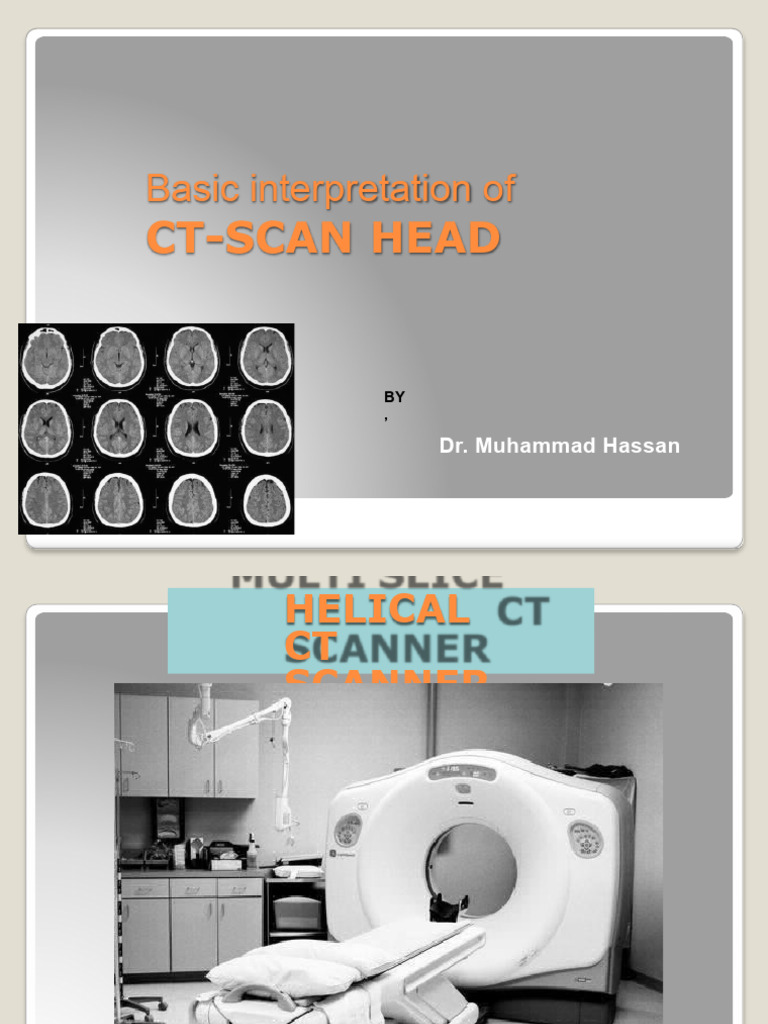 CT Scan | PDF | Ct Scan | Cerebrospinal Fluid