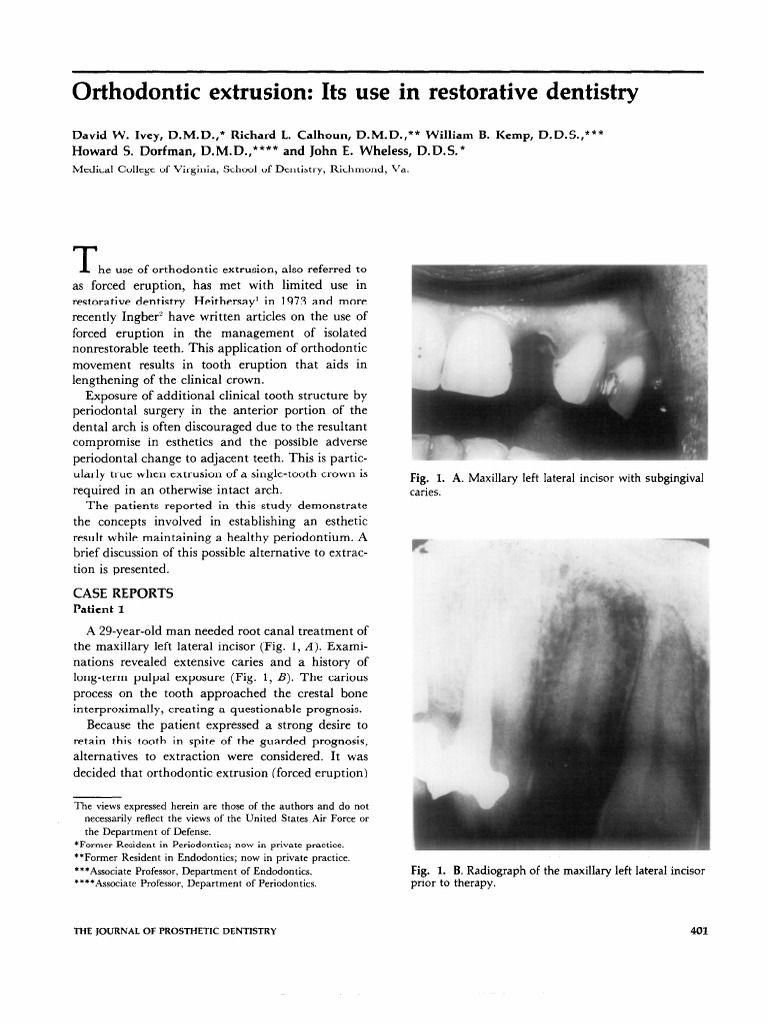 Orthodontic Extrusion - Its Use in Restorative Dentistry | PDF ...