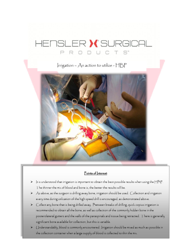 HBP Irrigation Tips | PDF