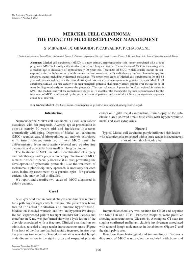Miranda 2012 | PDF | Metastasis | Lung Cancer