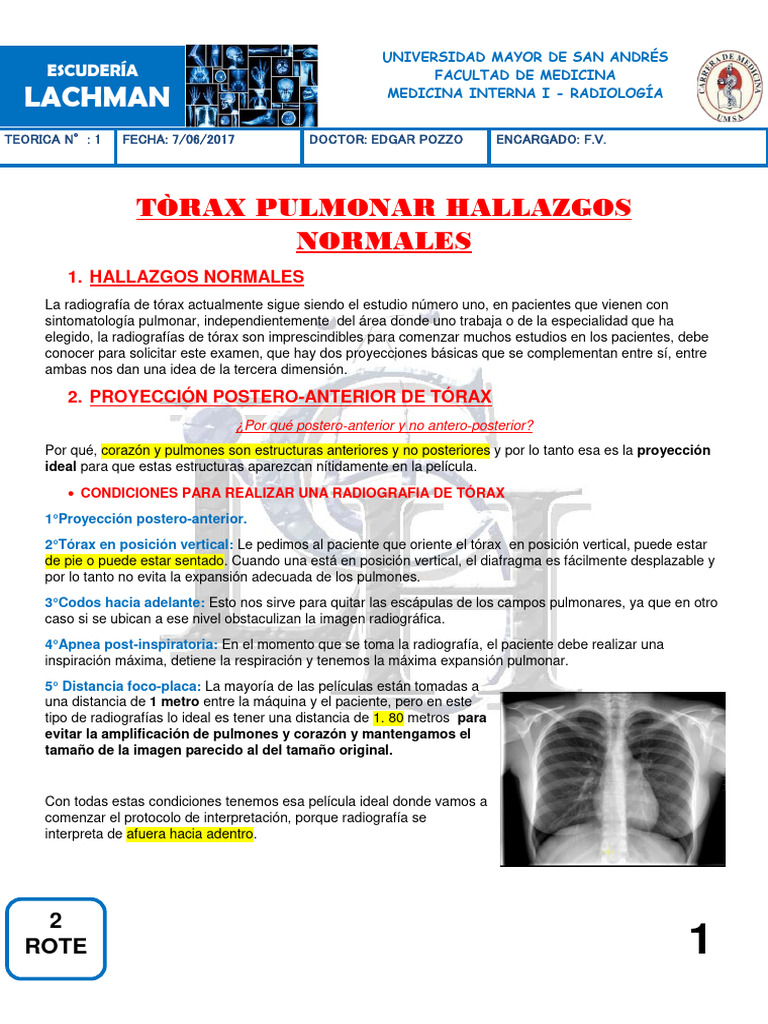 Radiologia Torax Normal y Patologica | Descargar gratis PDF ...