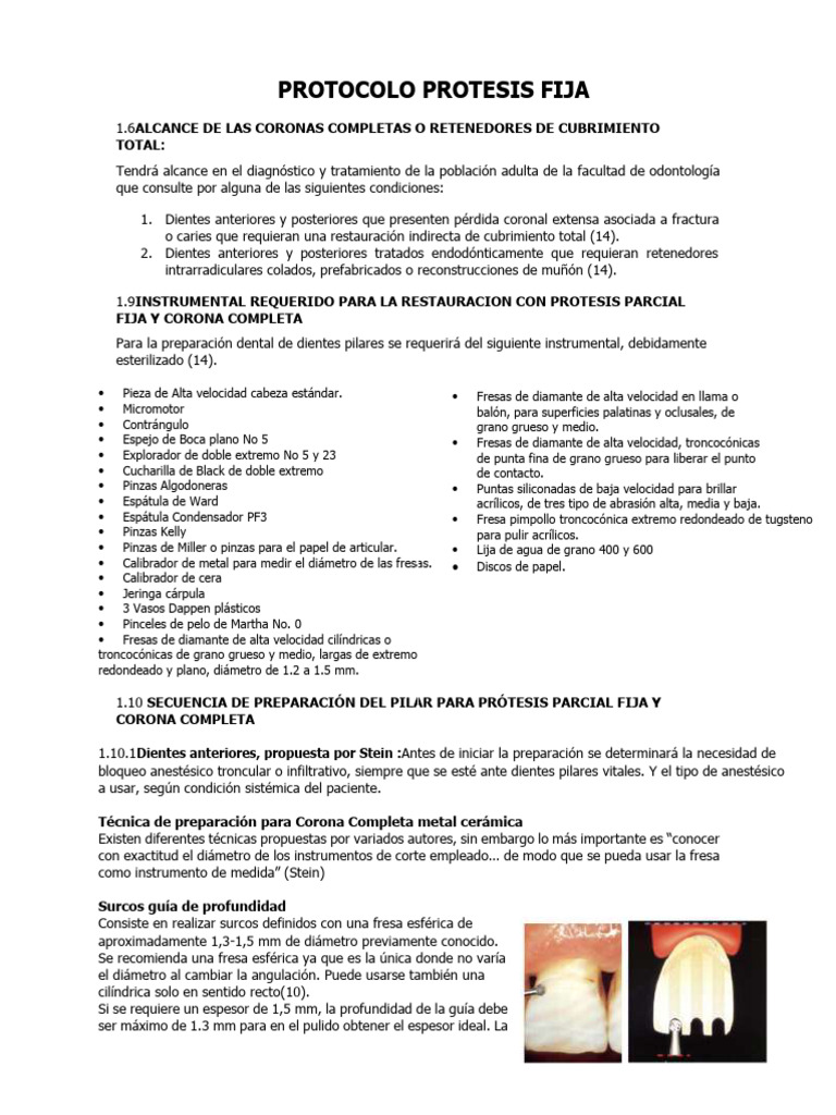 Protocolo Protesis Fija | PDF