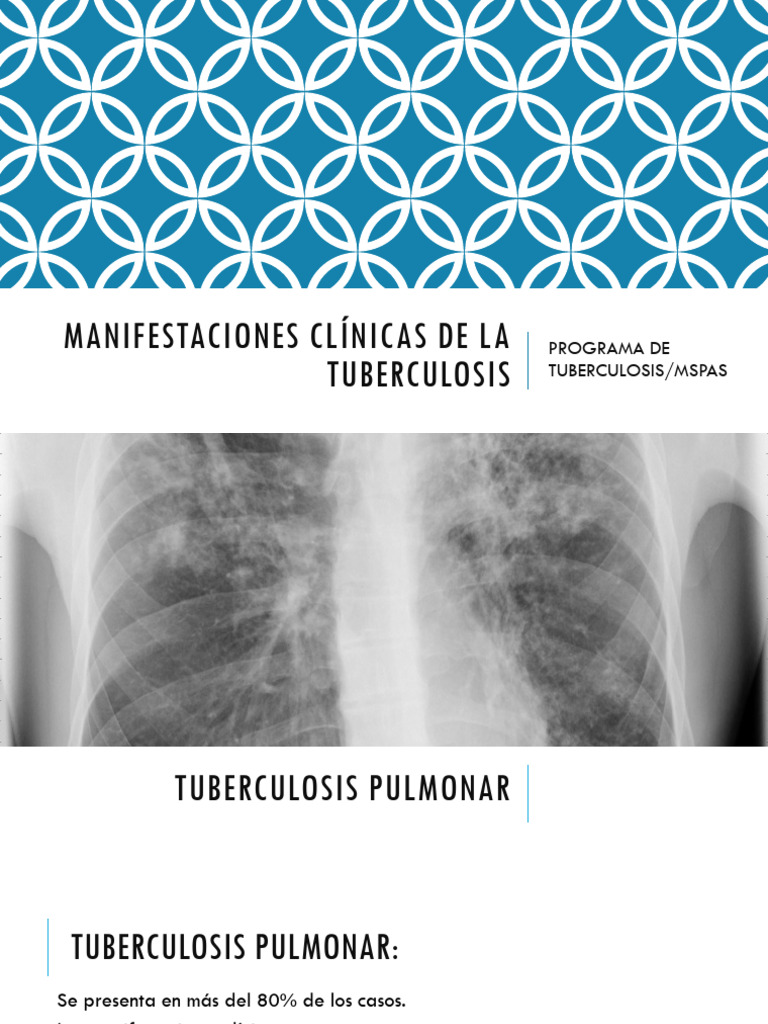 Manifestaciones Clínicas TB | PDF | Tuberculosis | Tos