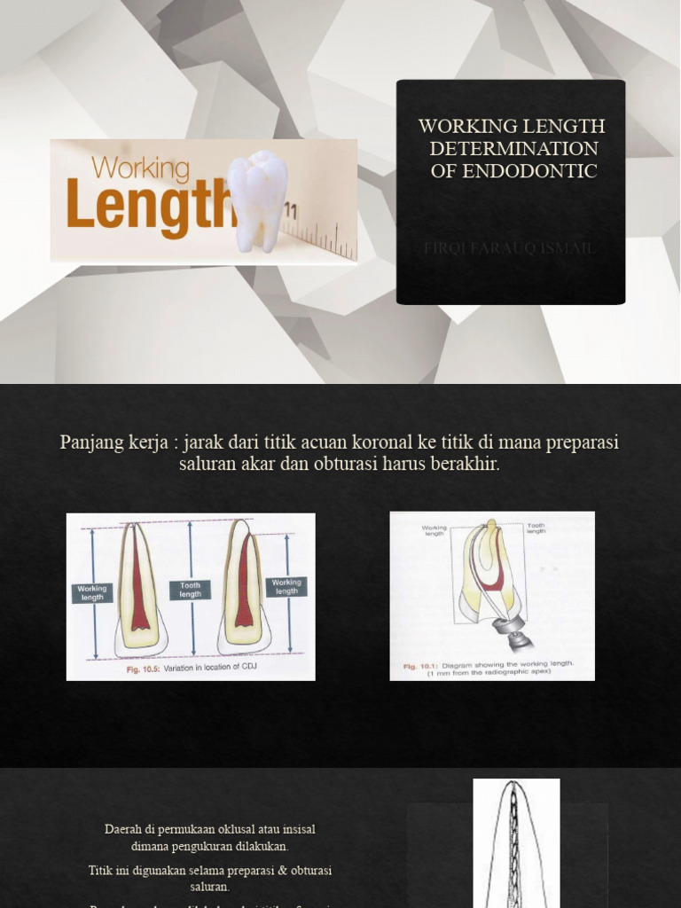 Working Length Determination of Endodontic | PDF