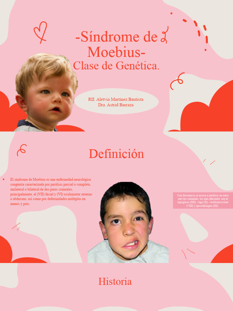 sindrome de moebius | PDF | Sistema nervioso | Medicina CLINICA
