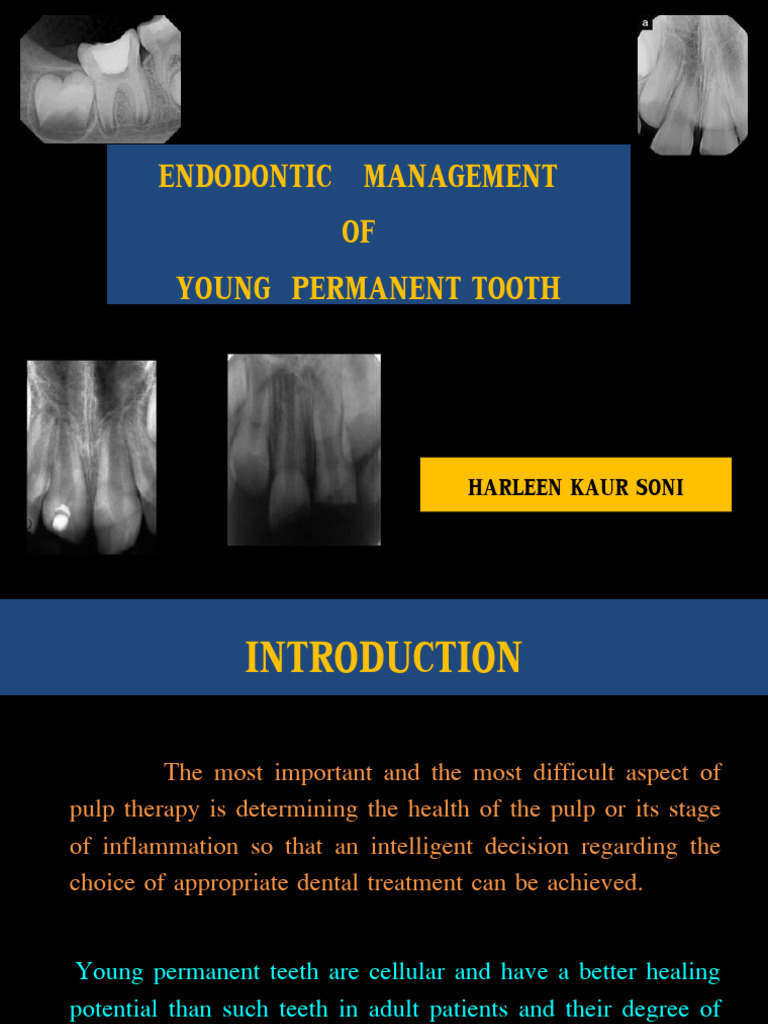 Endodontic Management of Young Teeth | PDF | Clinical Medicine ...