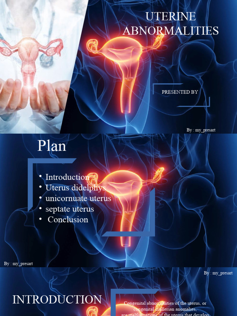 Uterus | PDF | Uterus | Miscarriage