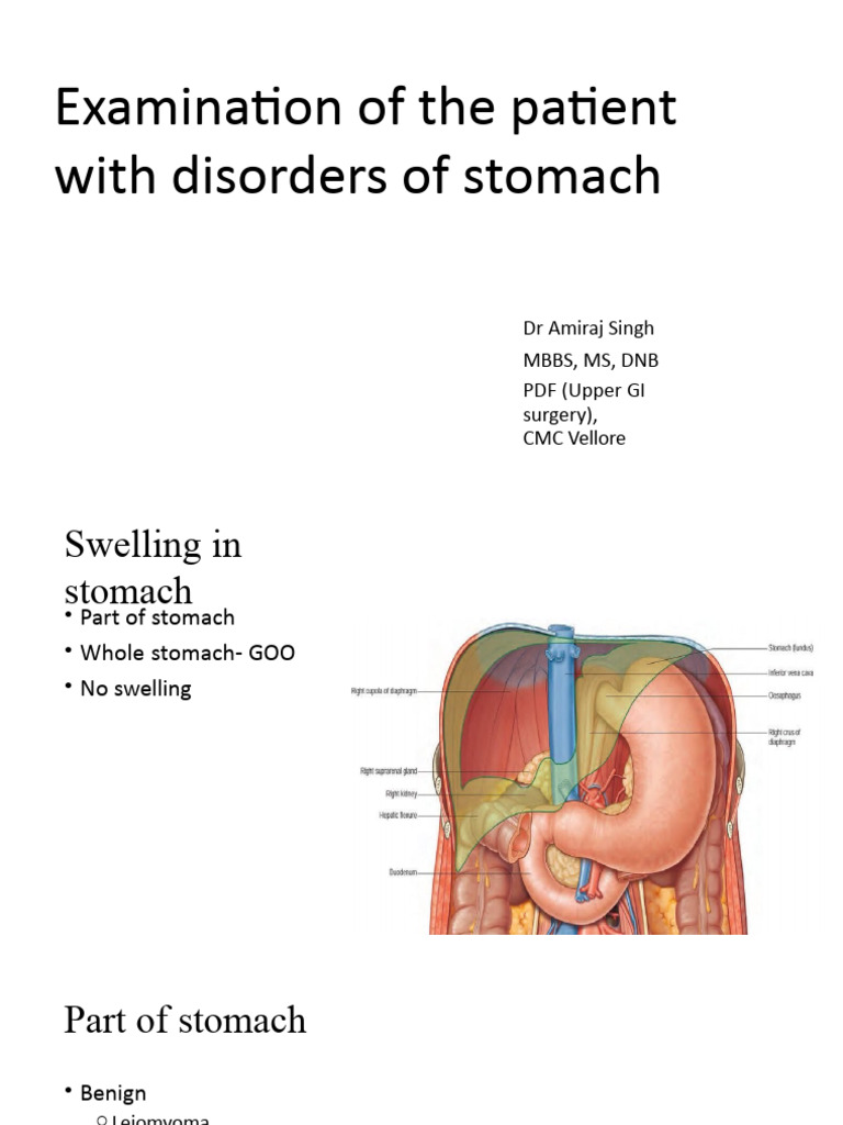 Gastric Outlet Obstruction | PDF | Stomach | Medical Specialties
