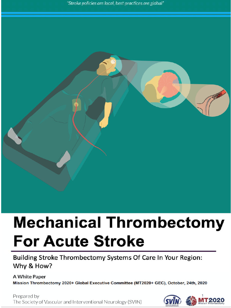 Mechanical Thrombectomy For Acute Stroke | PDF | Stroke | Clinical Medicine