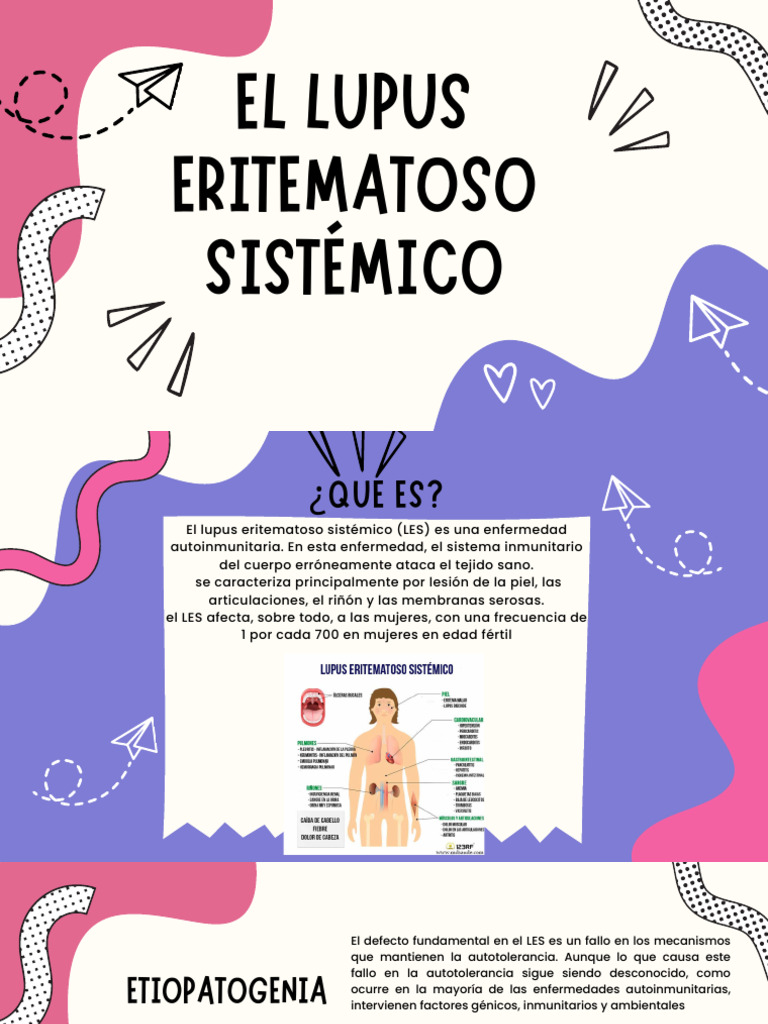 El Lupus Eritematoso Sistémico | PDF | Enfermedad autoinmune | Medicina