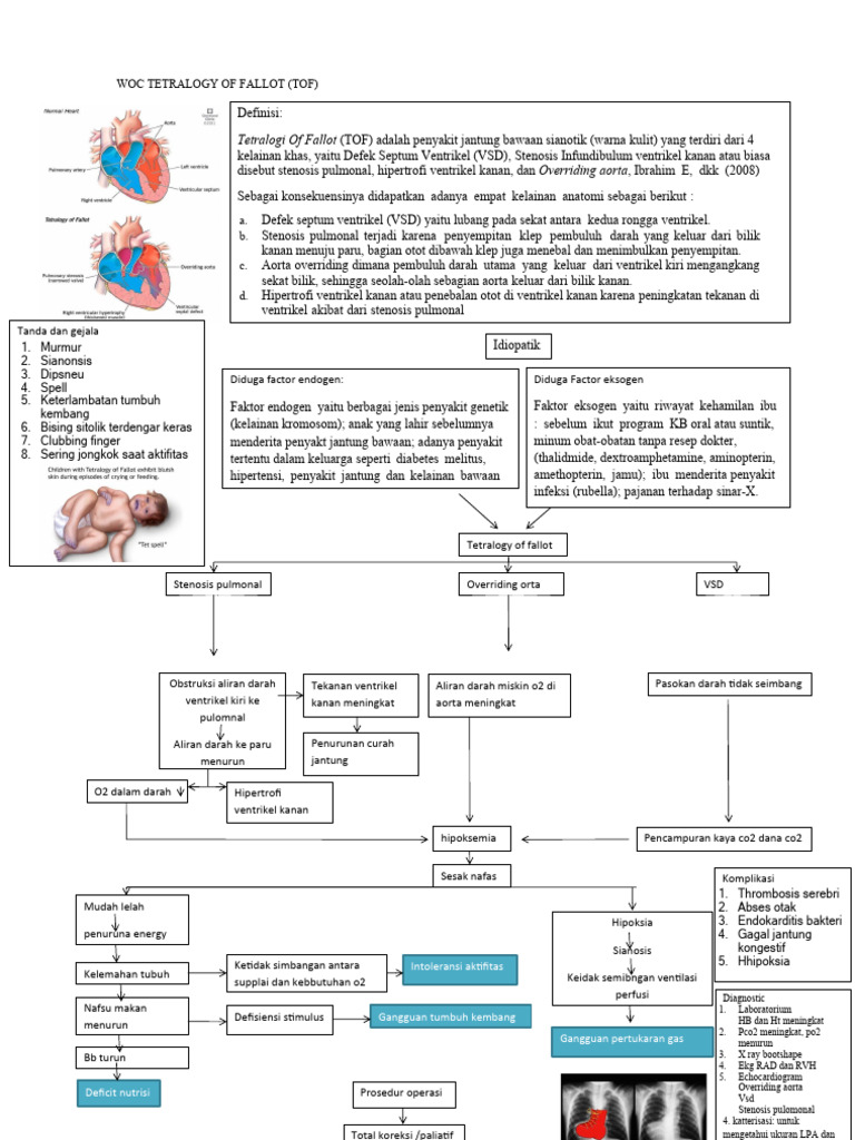 Woc Tetralogy of Fallot | PDF